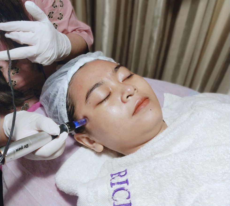 MESO TREATMENT - Clarice Beauty