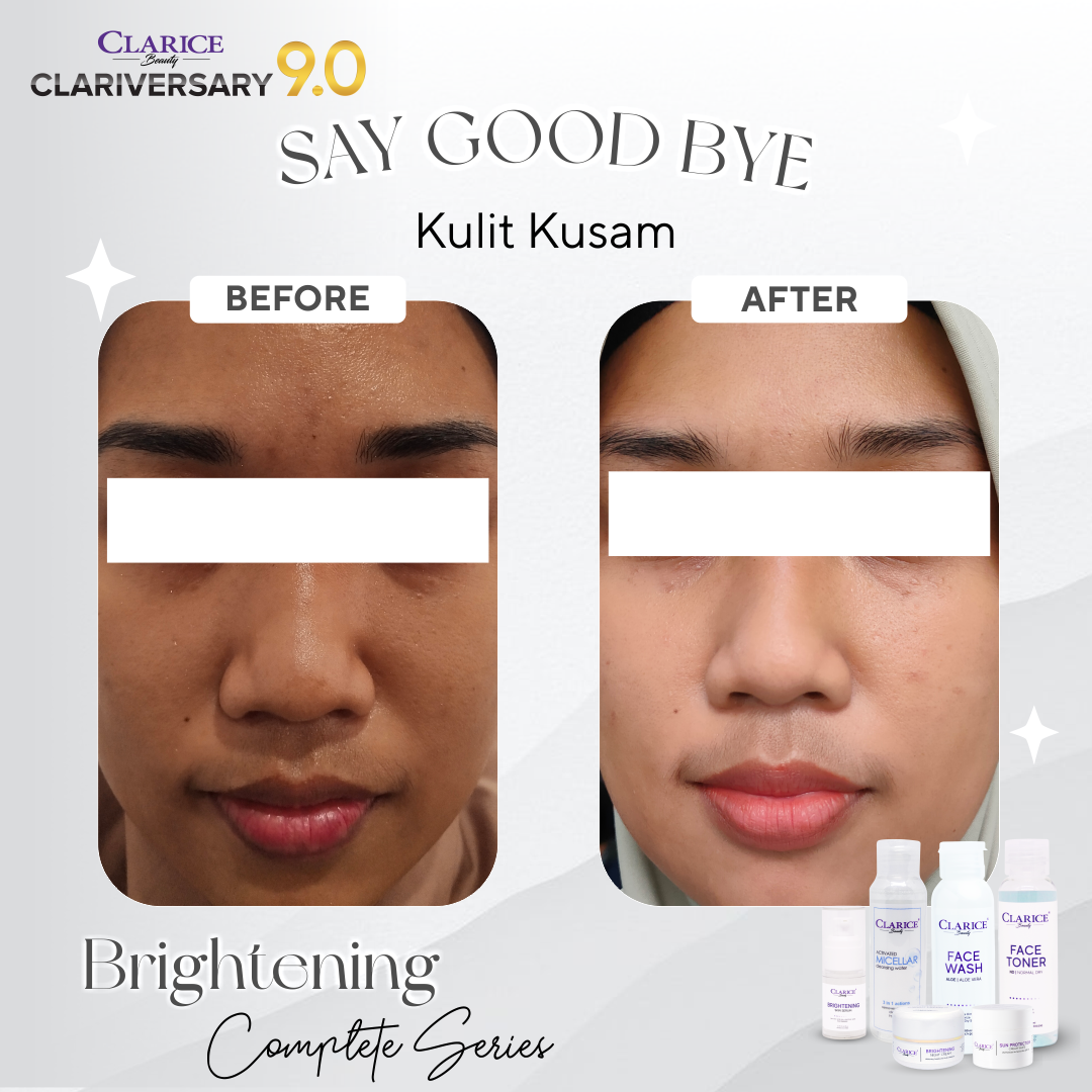 BRIGHTENING SERIES COMPLETE | Clarice Beauty